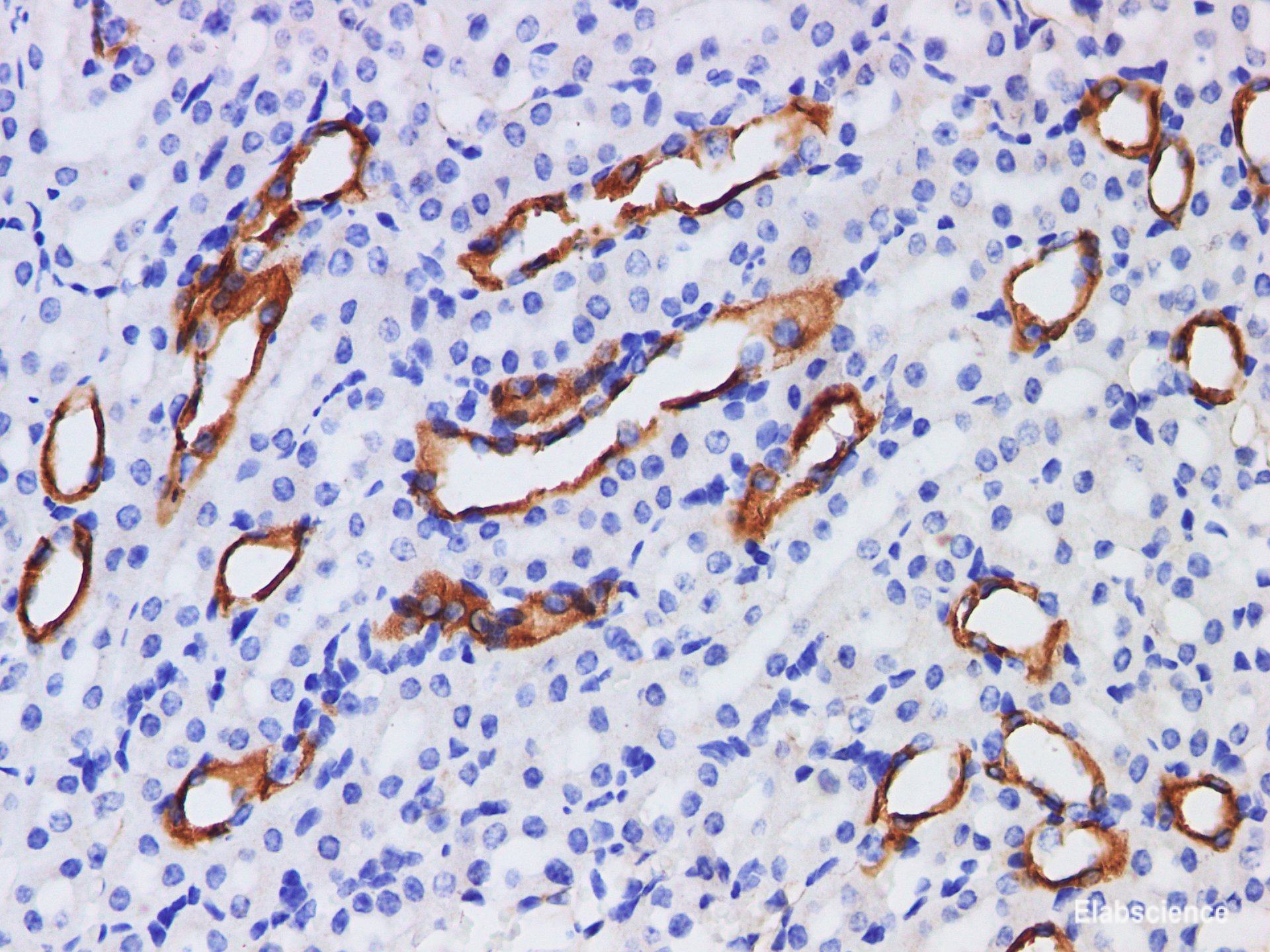 Ck7 Positivo Que Significa - RETOEDU