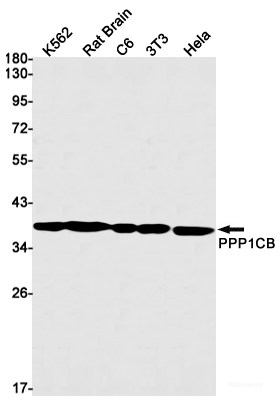 High Affinity and Specificity Recombinant PP1C beta Monoclonal Antibody ...