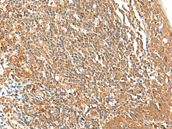 High Affinity and Specificity TSHB Polyclonal Antibody E-AB-17957 at ...
