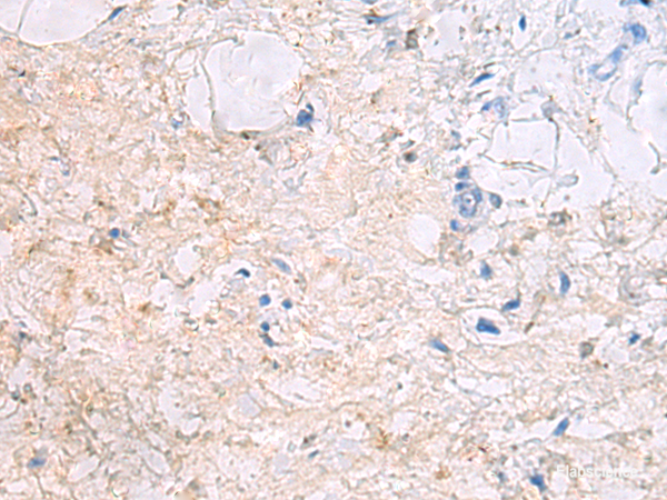 High Affinity and Specificity DPCD Polyclonal Antibody E-AB-19791 at ...