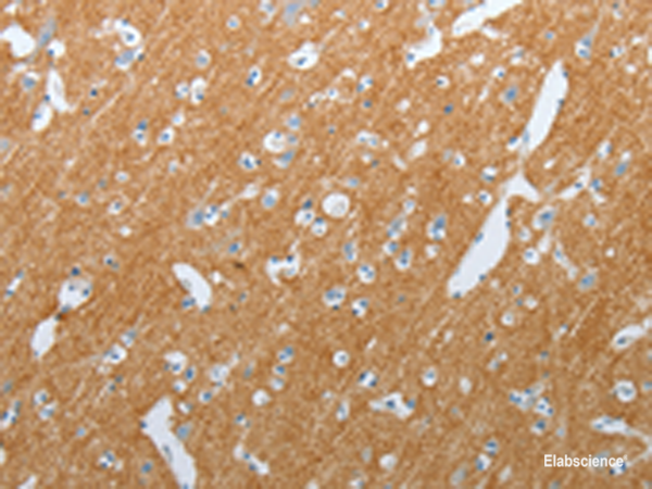 High Affinity and Specificity SLC17A7 Polyclonal Antibody E-AB-53199 at ...