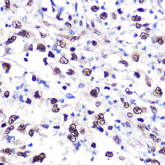 High Affinity and Specificity NCL Polyclonal Antibody E-AB-68385 at ...