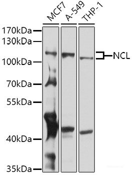 High Affinity and Specificity NCL Polyclonal Antibody E-AB-68385 at ...