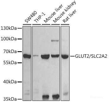 High Affinity and Specificity SLC2A2 Polyclonal Antibody E-AB-68431 at ...