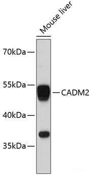 High Affinity and Specificity CADM2 Polyclonal Antibody E-AB-90304 at ...