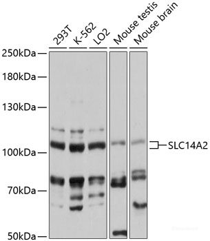 High Affinity and Specificity SLC14A2 Polyclonal Antibody E-AB-90608 at ...