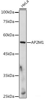 High Affinity and Specificity AP2M1 Polyclonal Antibody E-AB-90720 at ...