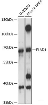 High Affinity and Specificity FLAD1 Polyclonal Antibody E-AB-90785 at ...