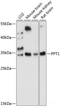 High Affinity and Specificity PPT1 Polyclonal Antibody E-AB-90948 at ...