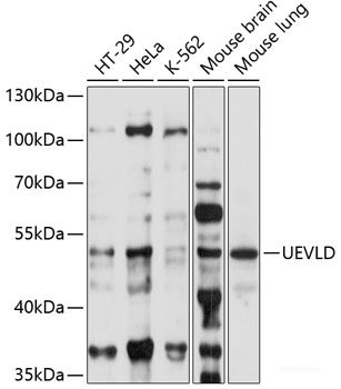 High Affinity and Specificity UEVLD Polyclonal Antibody E-AB-90996 at ...