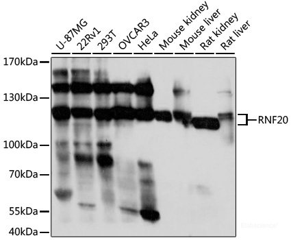 High Affinity and Specificity RNF20 Polyclonal Antibody E-AB-91760 at ...