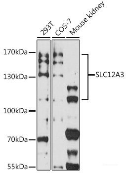 High Affinity and Specificity SLC12A3 Polyclonal Antibody E-AB-92031 at ...