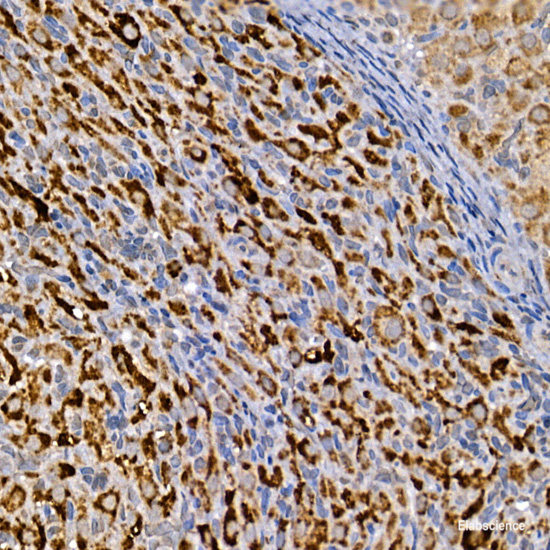 High Affinity and Specificity DVL3 Polyclonal Antibody E-AB-92555 at Elabscience.com