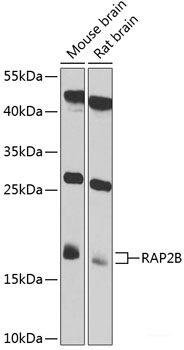 High Affinity and Specificity RAP2B Polyclonal Antibody E-AB-92567 at ...