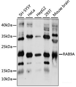 High Affinity and Specificity RAB9A Polyclonal Antibody E-AB-92752 at Elabscience.com