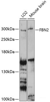 High Affinity and Specificity FBN2 Polyclonal Antibody E-AB-92963 at ...
