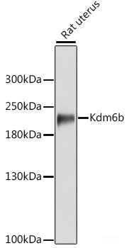 High Affinity and Specificity Kdm6b Polyclonal Antibody E-AB-93092 at ...