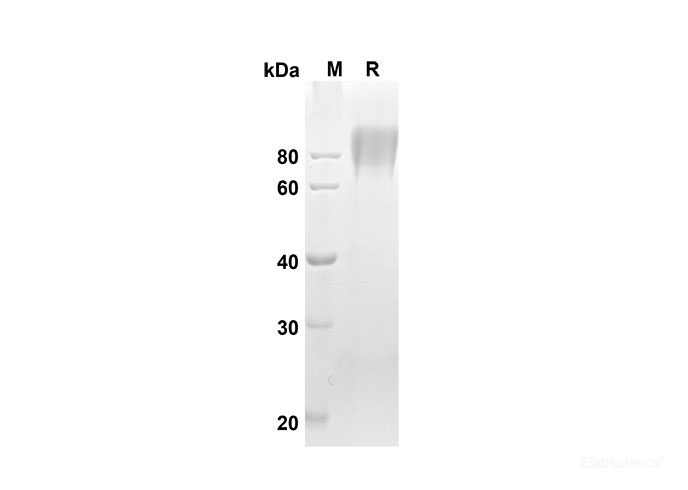Quality Reliable Recombinant Human CD86 Protein(Fc Tag) PDMH100249 at ...
